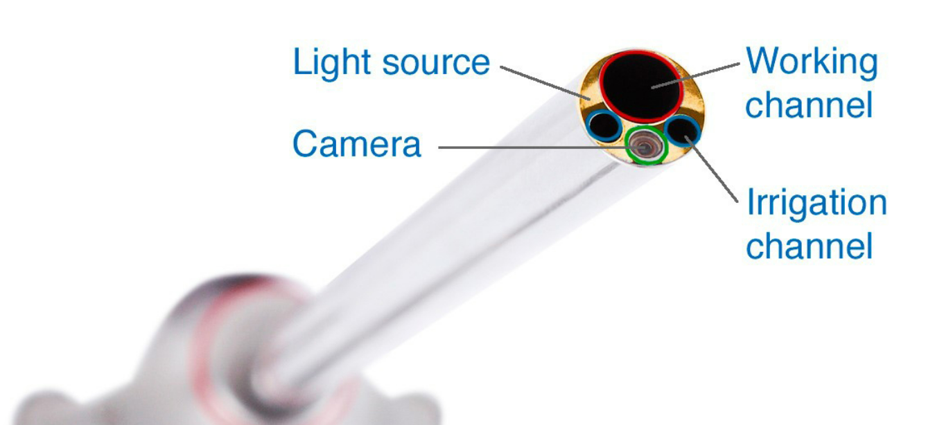 Endoscopy/Transmission Beam Polishing Solution – Shenzhen Neofibo ...